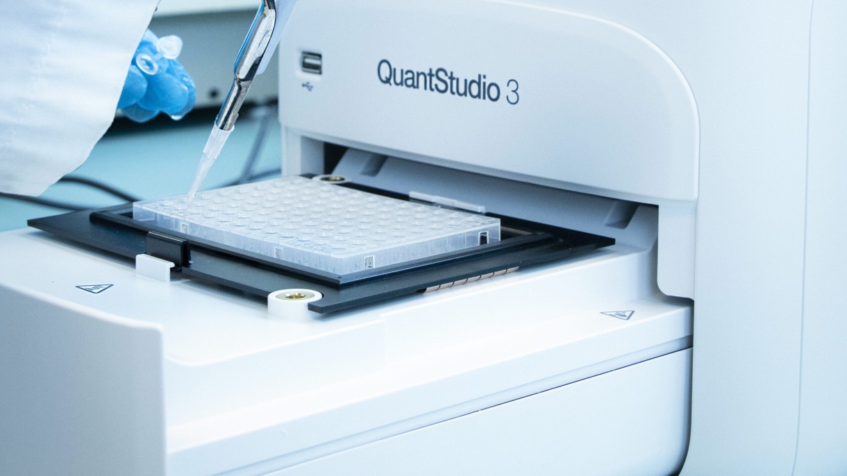 Basic and Translational Studies | Neurosurgery | Medical School | Brown University